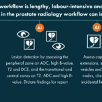 Quantib® Prostate Now Integrates with Focal Healthcare’s Fusion Bx ...